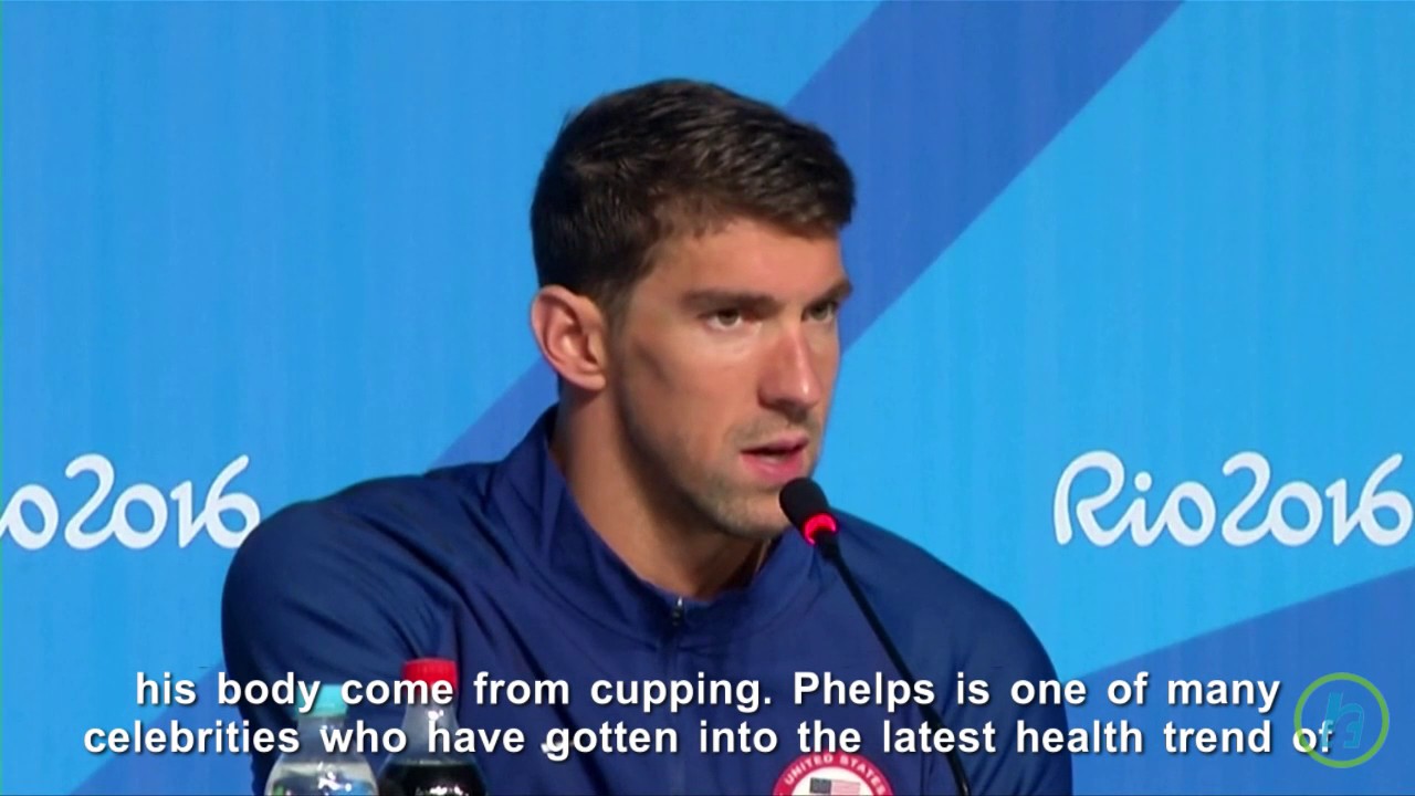 Olympian Michael Phelps Uses Cupping Treatment - YouTube