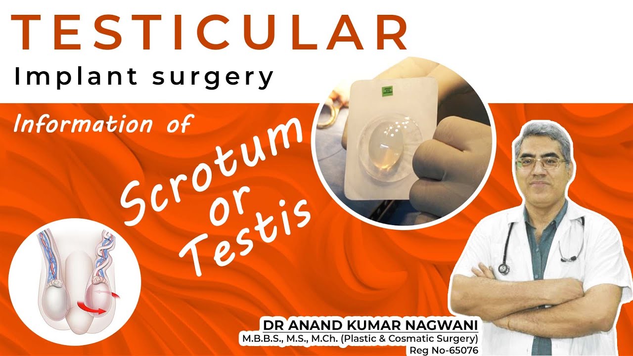 Testicular Implant for absent testes | अंडकोष की PROSTHESIS SURGERY ...