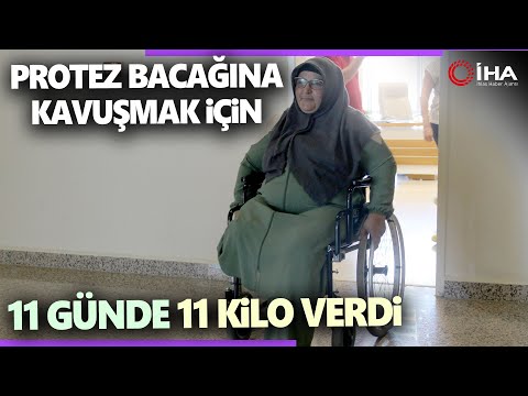 7 Yılda 7 Ameliyat Oldu, Protez Bacağının Takılacağı Günü İple Çekiyor
