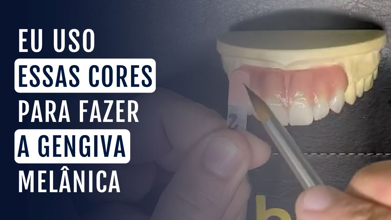 EU USO ESSAS CORES PARA FAZER A GENGIVA MELÂNICA | Ginetom Rodrigues ...