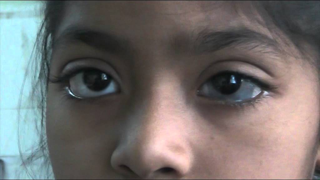 Blue Sclera - YouTube