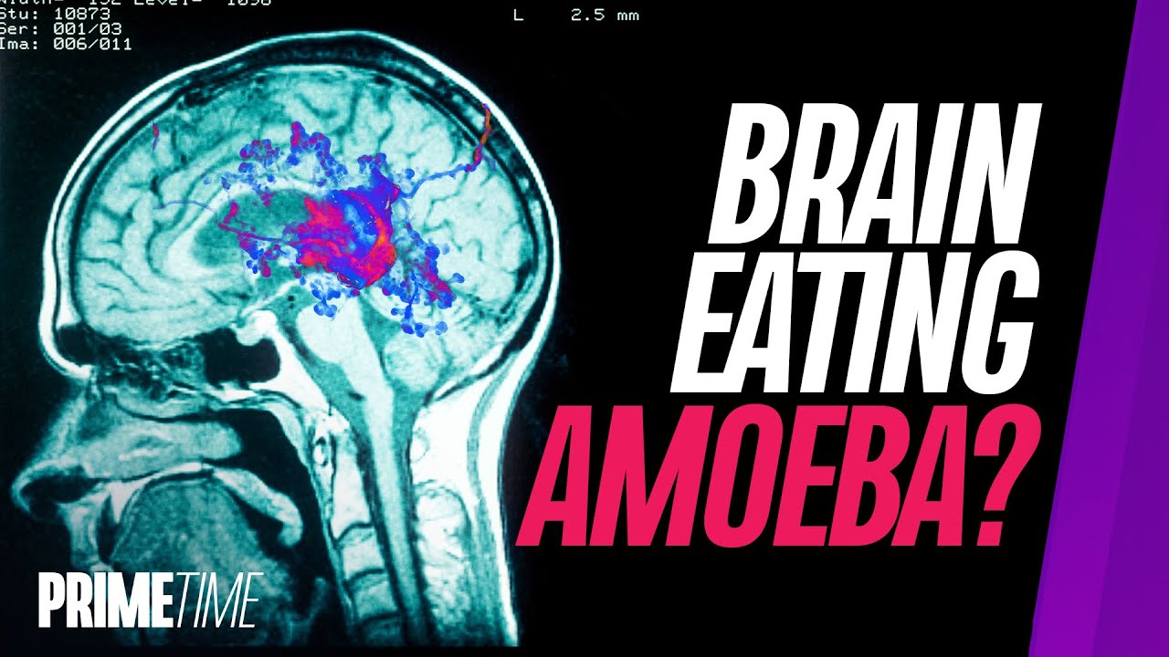 Brain Eating AMOEBAS Found in 20 States in the U.S. - YouTube