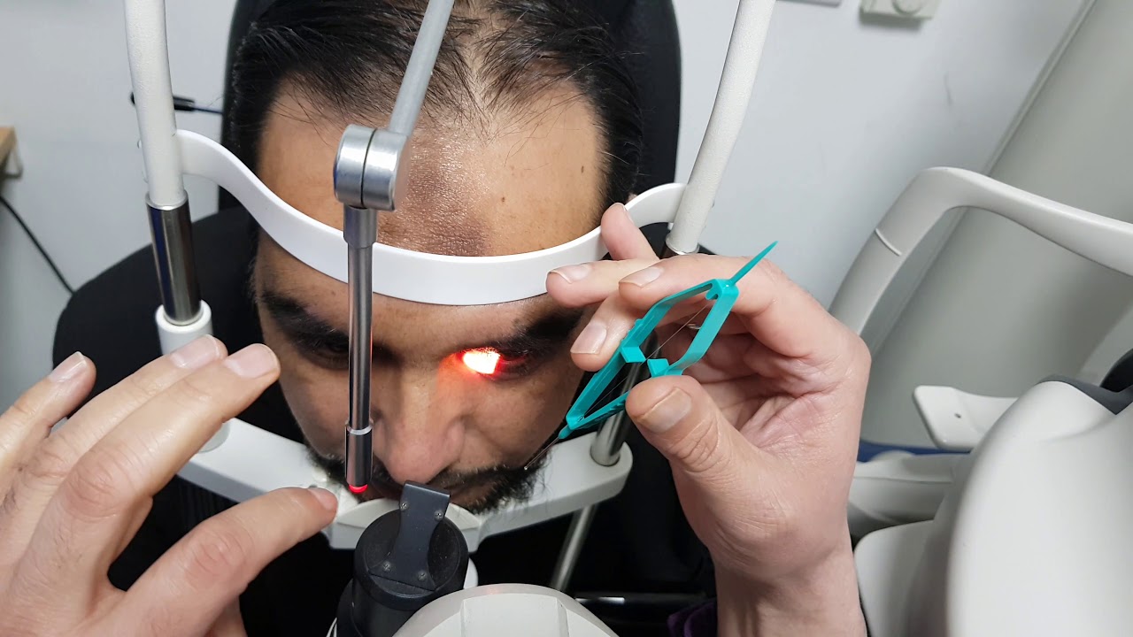 Insertion Of Punctum Plugs YouTube insertion-of-punctum-plugs-youtube