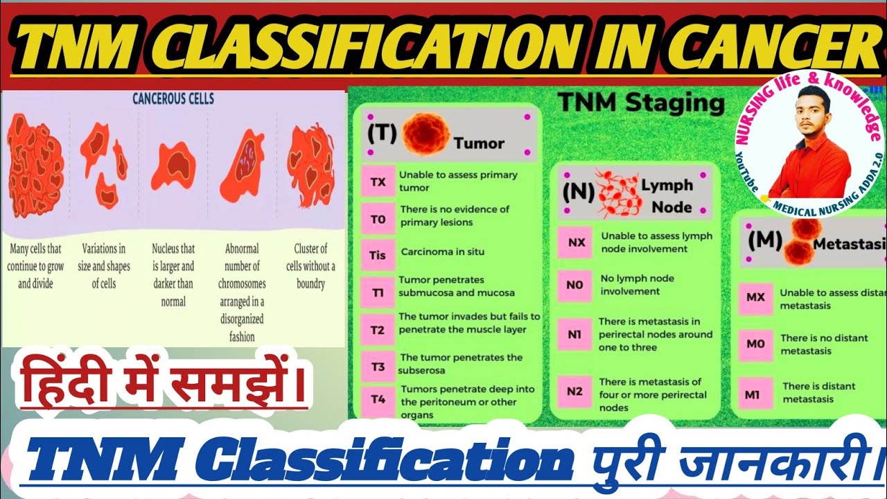 TNM classification /tnm classificationof cancer /tnm classification of ...