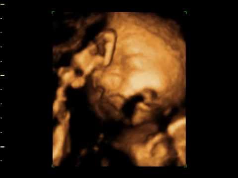 dünyada bir ilk  Anne karnında 6aylık bebek öpücük atıyor 3