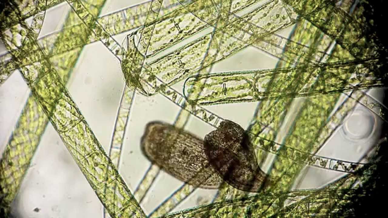 🔬 Mikroorganismen unter den Mikroskop - microorganisms under microscope ...