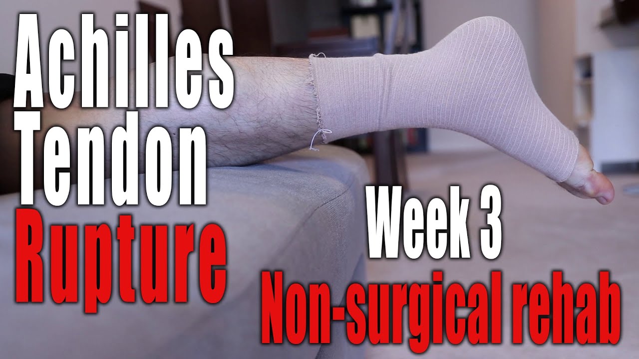 Achilles Tendon Rupture, Non-Surgical Recovery | Week 3: Day 16 ...