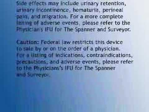 The Spanner Prostatic Stent Prescribing Information - YouTube