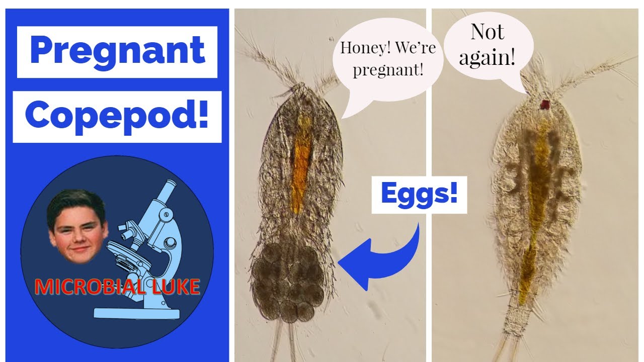 'PREGNANT' COPEPOD UNDER A MICROSCOPE! | Microscope Monday - YouTube