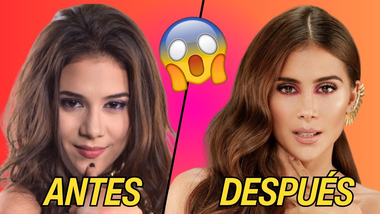GREEICY RENDÓN | ANTES Y DESPUÉS ¿DE QUÉ SE OPERÓ? - YouTube