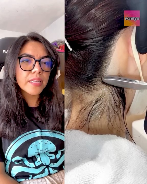 Elimina los Pelitos de la Nuca de Forma Estética | Depilación Perfecta - YouTube