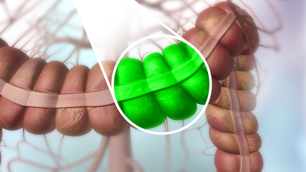 The Benefits of ICG Imaging in Surgery - YouTube