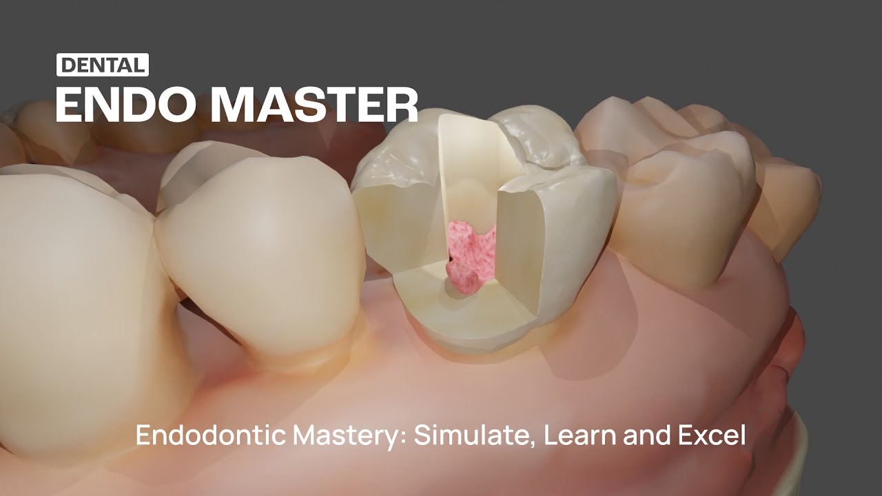 Introducing Dental EndoMaster - YouTube