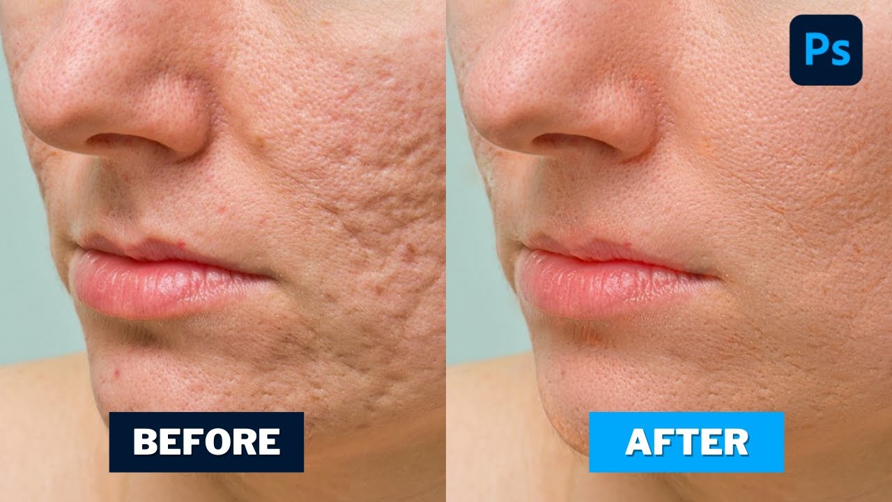 High end Skin Retouching Photoshop Tutorial - Creative Graphic Tv - YouTube