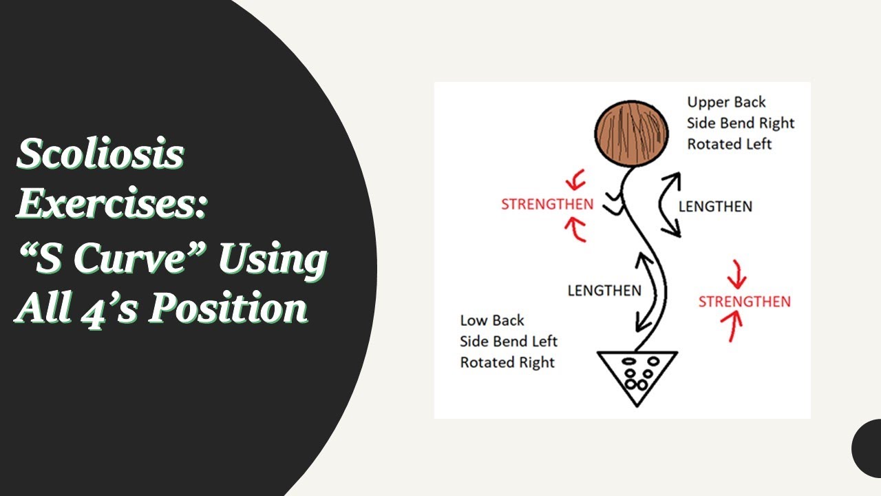 Scoliosis Exercises "S Curve" using all 4 position - YouTube