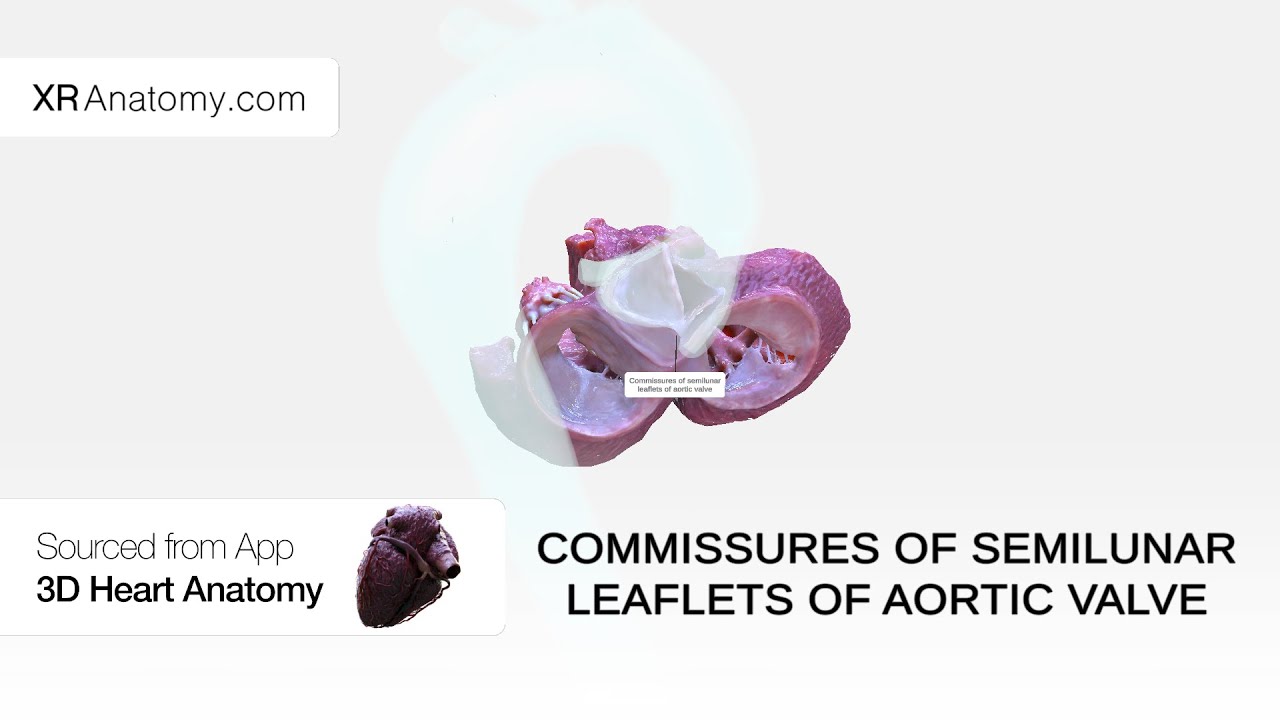 Commissures of semilunar leaflets of aortic valve - YouTube