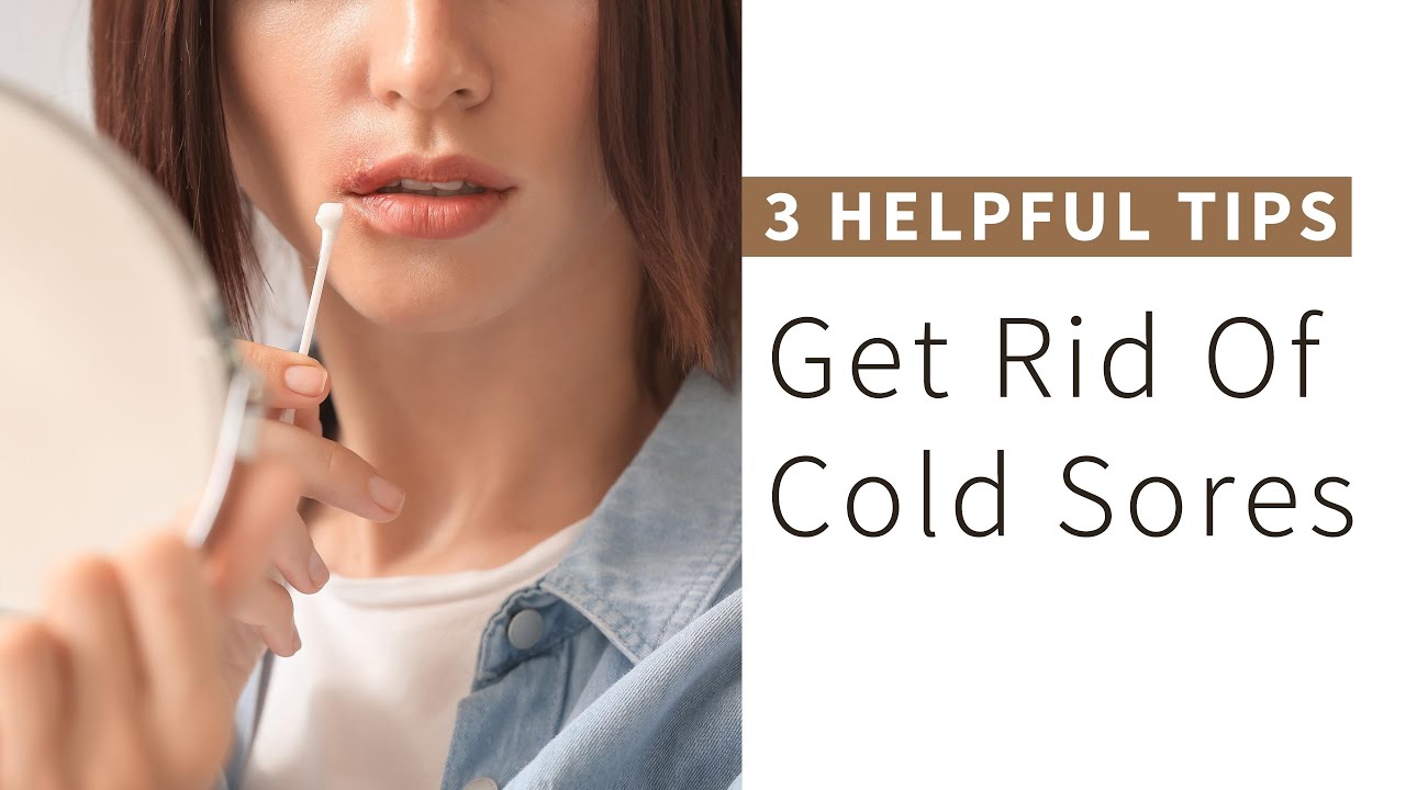 How To Get Rid Of Cold Sores | 3 Helpful Tips About Cold Sore Diagnosis ...