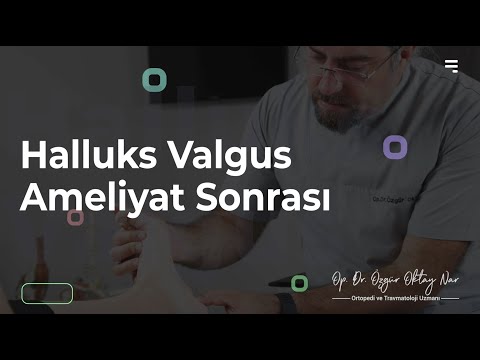 Halluks Valgus Ameliyat Sonrasi Surec | Op. Dr. Ozgur Oktay Nar
