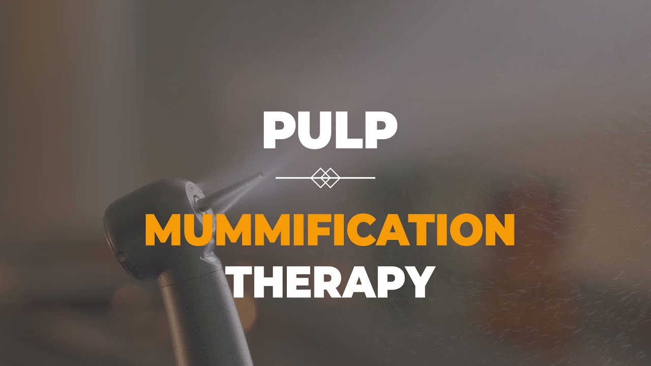 PMT Pulp Mummification Therapy | Hassaan Dental Clinic Islamabad ...