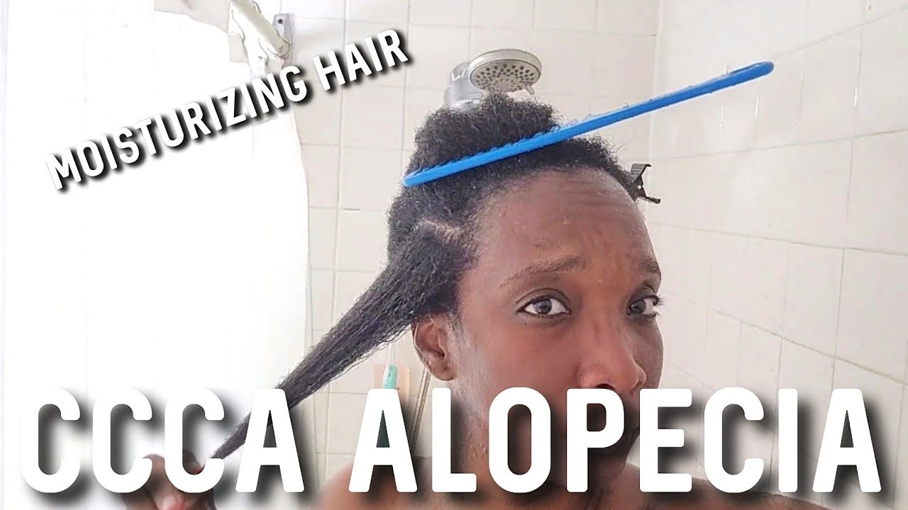 CCCA Alopecia Hair Update | Hair Loss & Scalp Care #alopeciahairloss ...