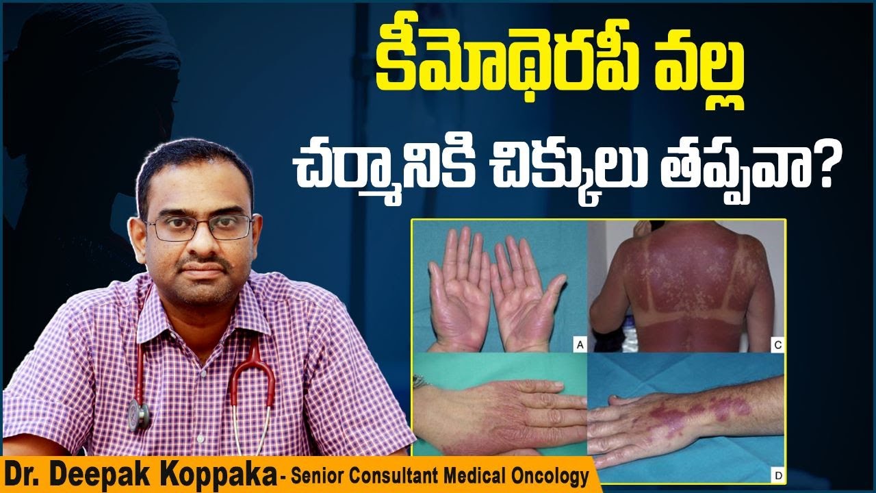 చర్మంపై కీమోథెరపీ ప్రభావాలు || How to Prevent Chemotherapy ...