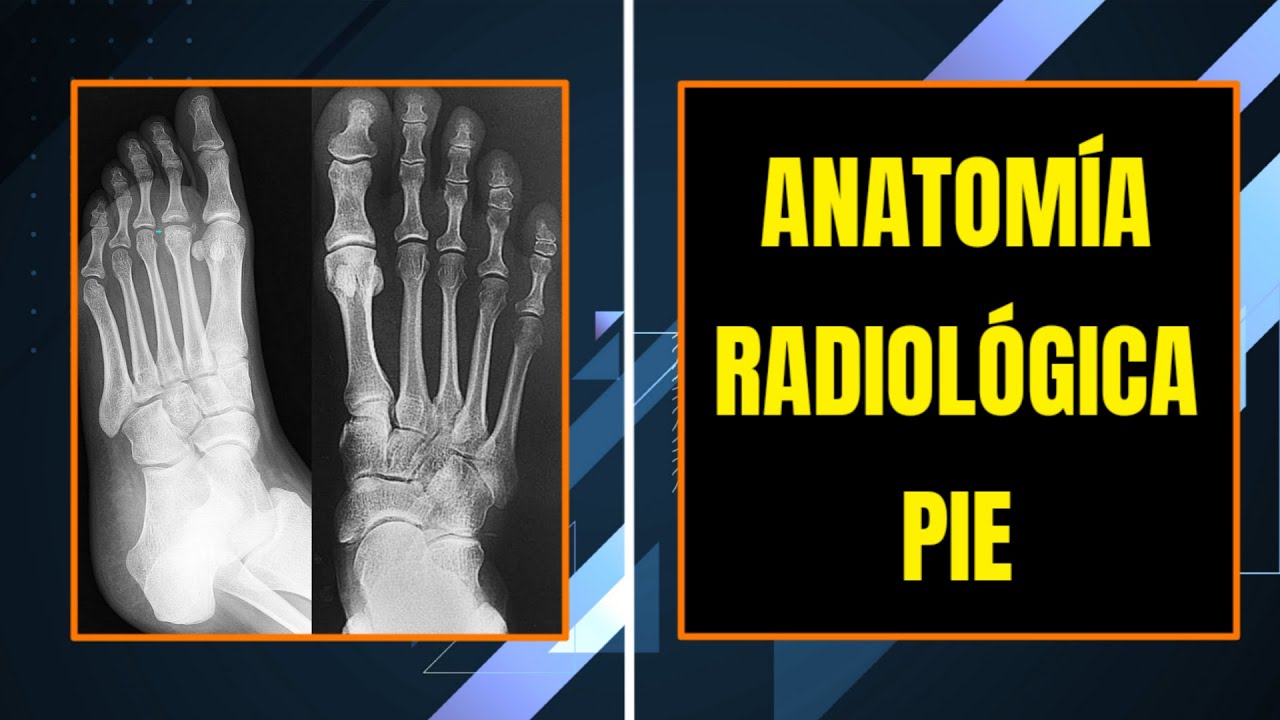 Anatomía Radiológica del Pie (AP, Lateral y Oblicua) Explicada Paso a ...