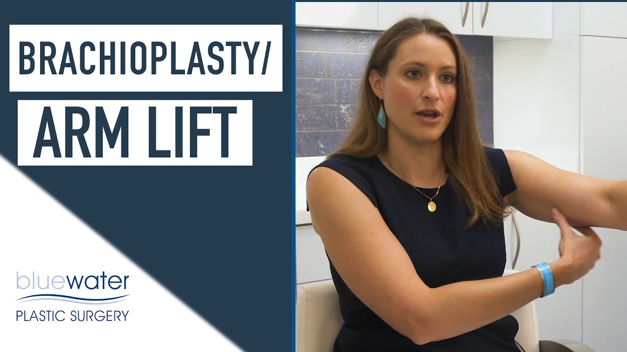 How To Get Rid of Batwing Arms? | Brachioplasty Surgery Raleigh | Blue ...