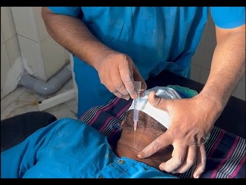 Needle cricothyroidotomy | Dr.S.Parthasarathy MD., DNB, PhD - YouTube