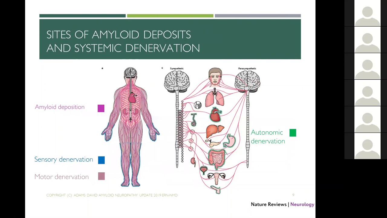 "Amyloid Neuropathies: update in 2019" by David Adams - YouTube