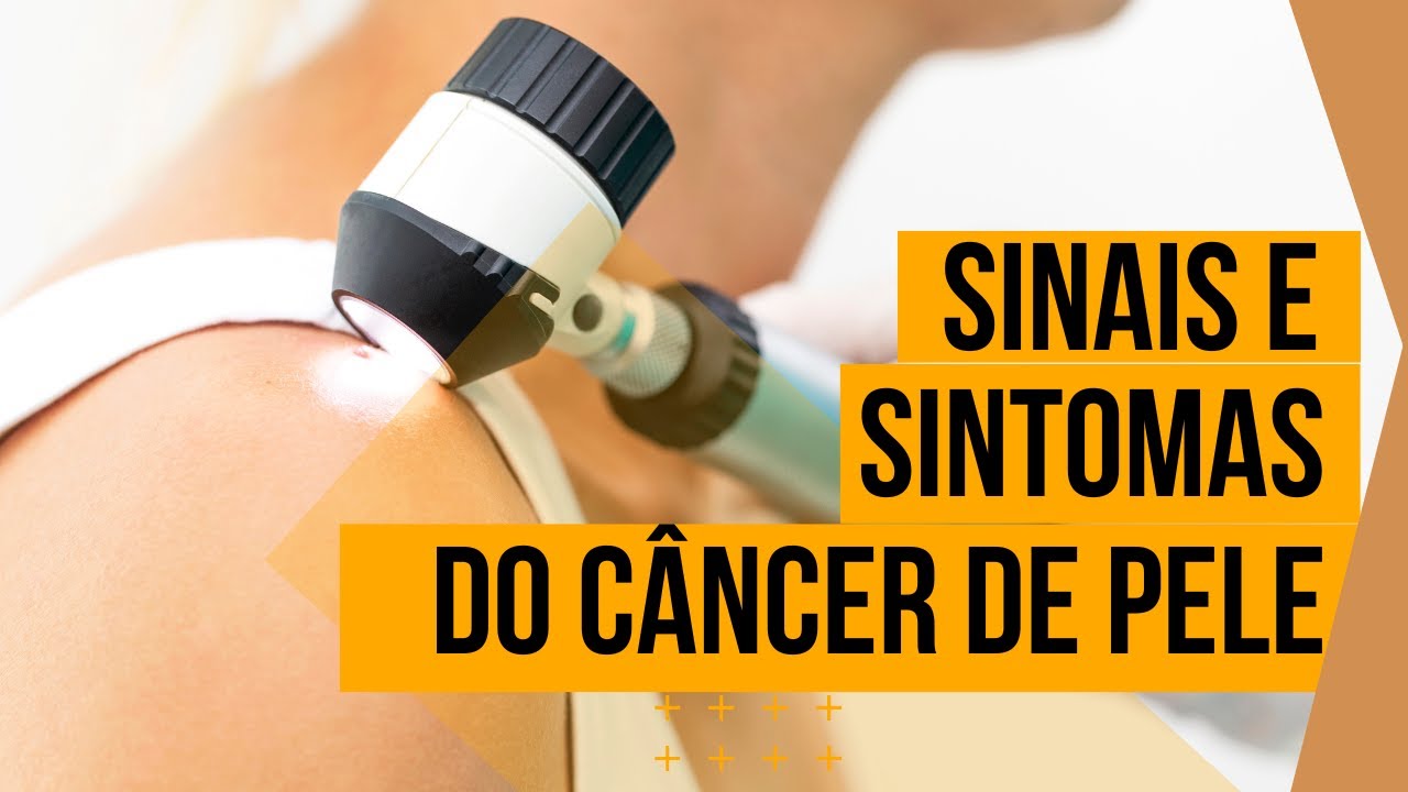 SINAIS E SINTOMAS DO CÂNCER DE PELE | Saiba como identificar as lesões ...