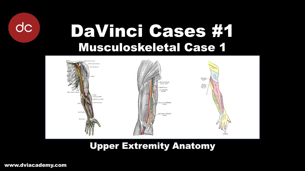 Upper Extremity Anatomy Case [#DaVinciCases Musculoskeletal 1] - YouTube