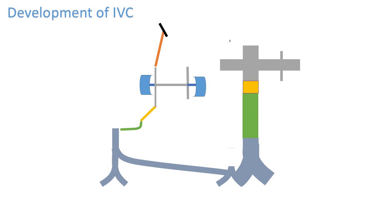 Inferior vena cava development - YouTube