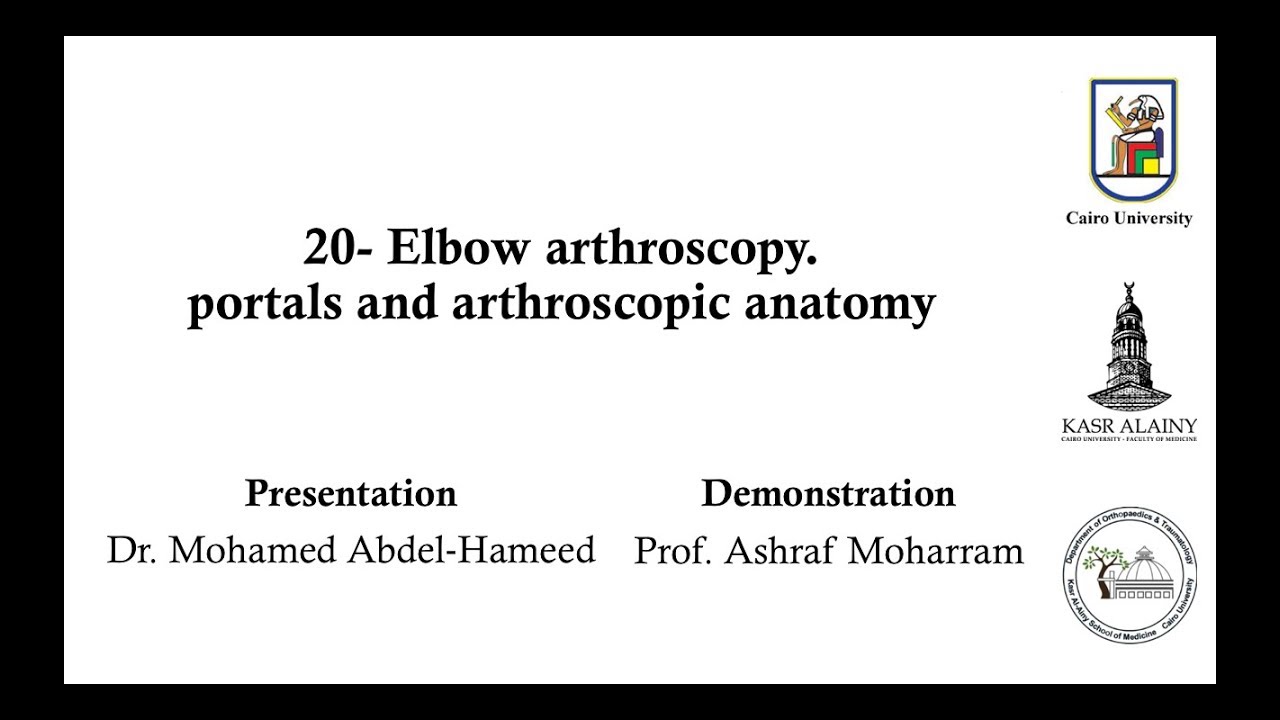 20 Elbow arthroscopy: portals and arthroscopic anatomy - YouTube
