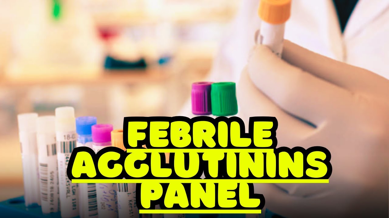 FEBRILE AGGLUTININS PANEL - YouTube