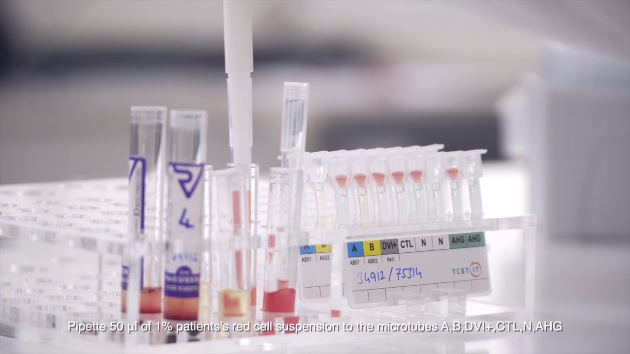 TG112 TEST IT GEL CROSS MATCH Blood Grouping Gel Card Test Procedure tg112-test-it-gel-cross-match-blood-grouping-gel-card-test-procedure