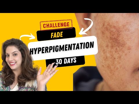 Hyperpigmentation Removal Remedy at Home in 30 days I Hyperpigmentation ...