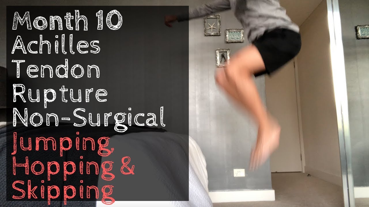 Month 10: Achilles Tendon Rupture Non-Surgical - Jumping, Hopping ...