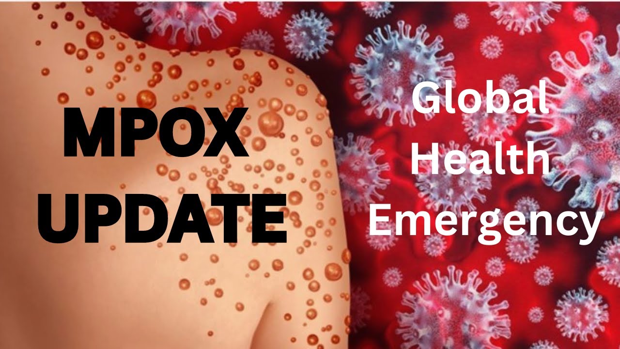 Mpox Outbreak Update - What You Need to Know - YouTube