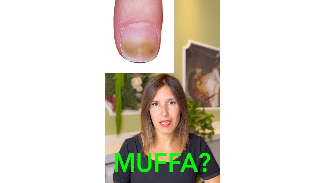 [ NAILTIPS 02 ] MUFFA UNGHIE ? Vediamo di cosa si tratta Veramente ...