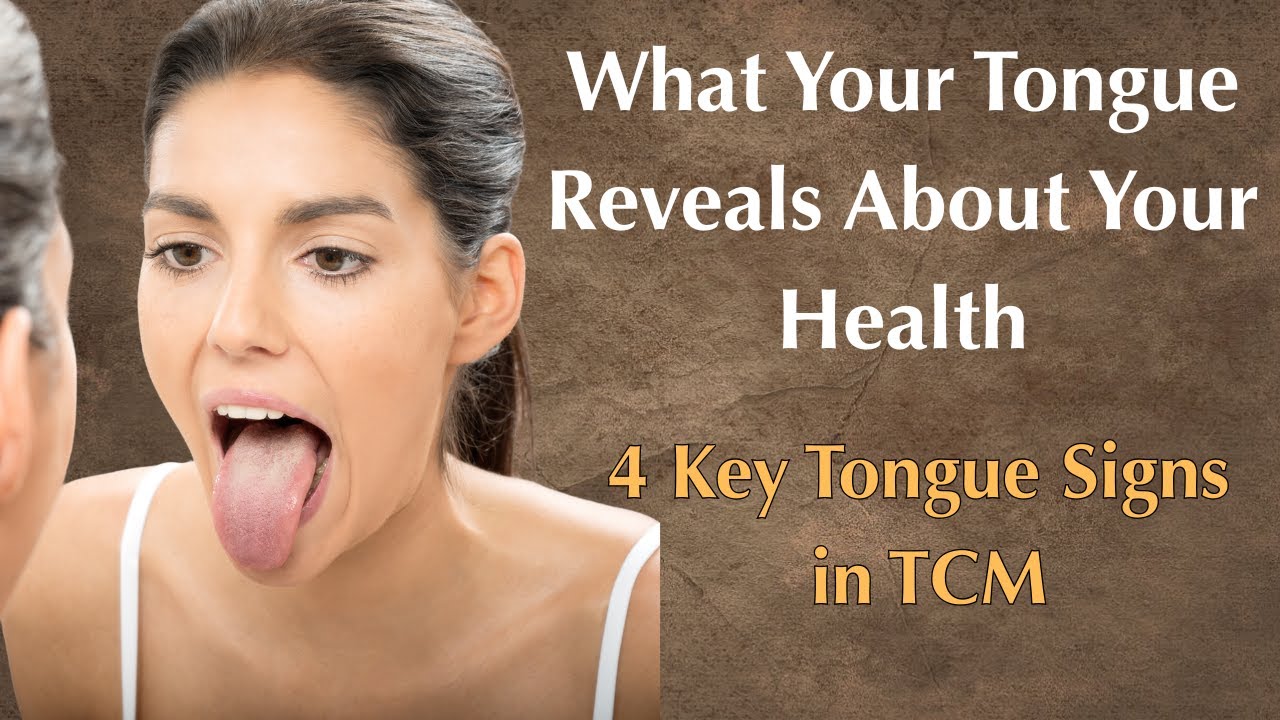 What Your Tongue Reveals About Your Health: 4 Key Tongue Signs in TCM ...