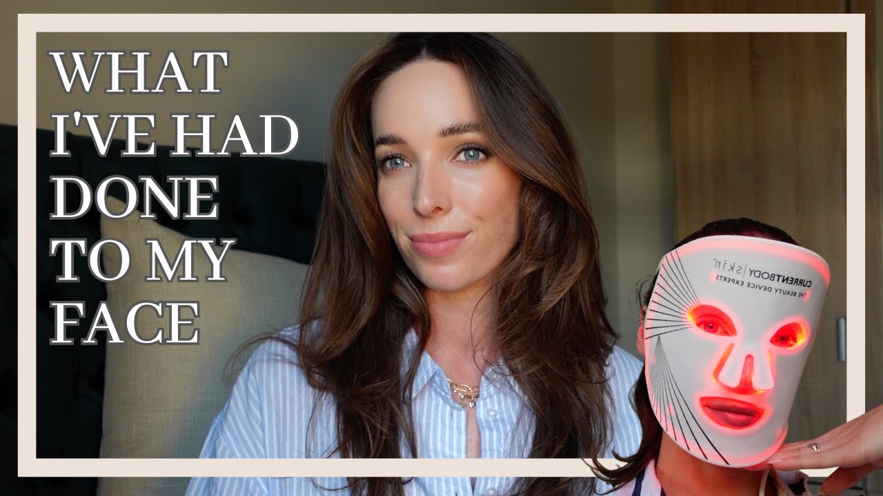 WHAT I'VE HAD DONE TO MY FACE | Botox? Dermal Filler? Lips? | Bridal ...