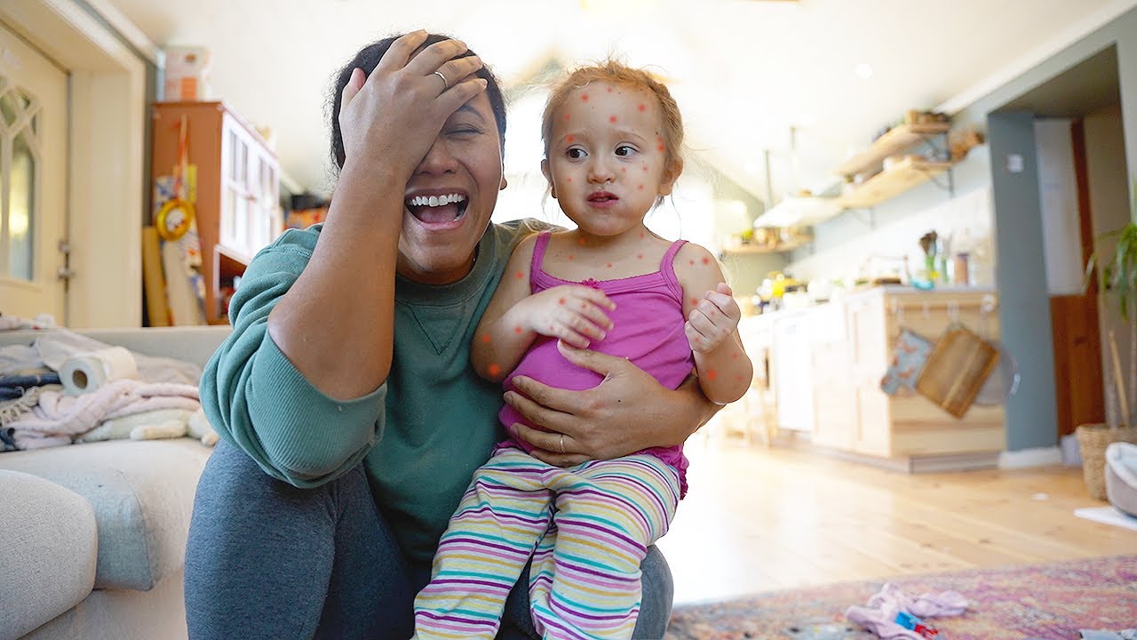 Our Daughter Got Chicken Pox: Day in the Life with a Sick Child - YouTube