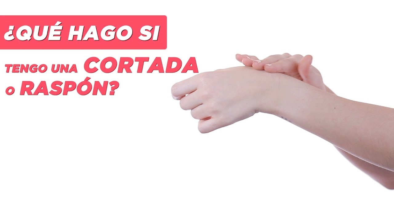 ¿Qué hago si tengo una cortada o un raspón? | Salud180 - YouTube