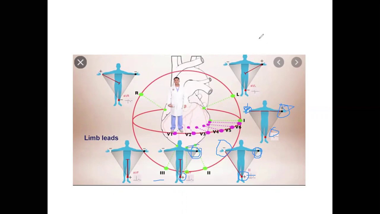 ECG Mcqs |Electrocardiogm MBBS - YouTube