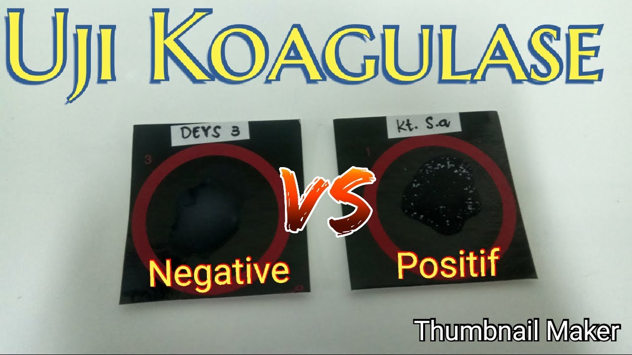 Uji Koagulase Bakteri Stapilococcus aureus - YouTube