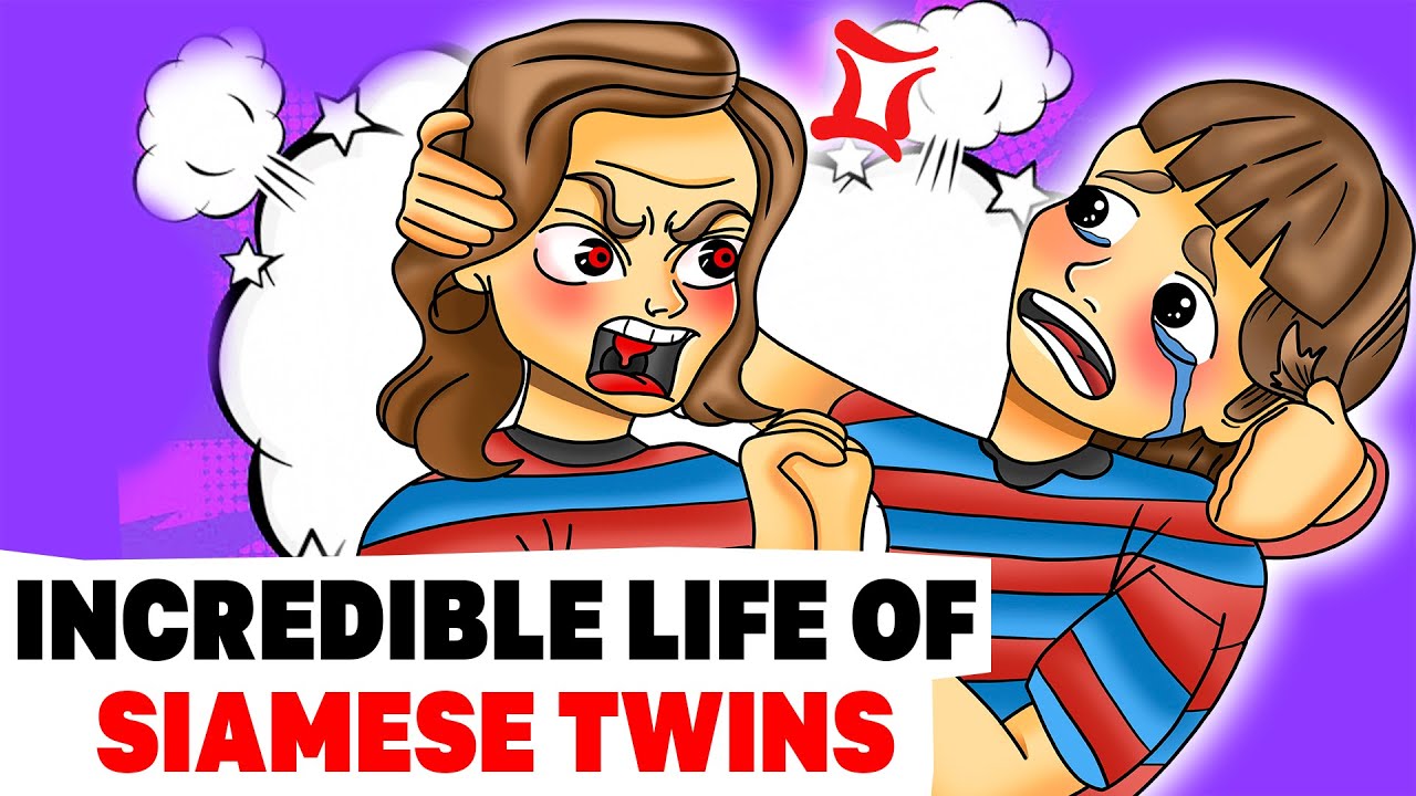 The Incredible Life of Siamese Twins | My Story Animated - YouTube