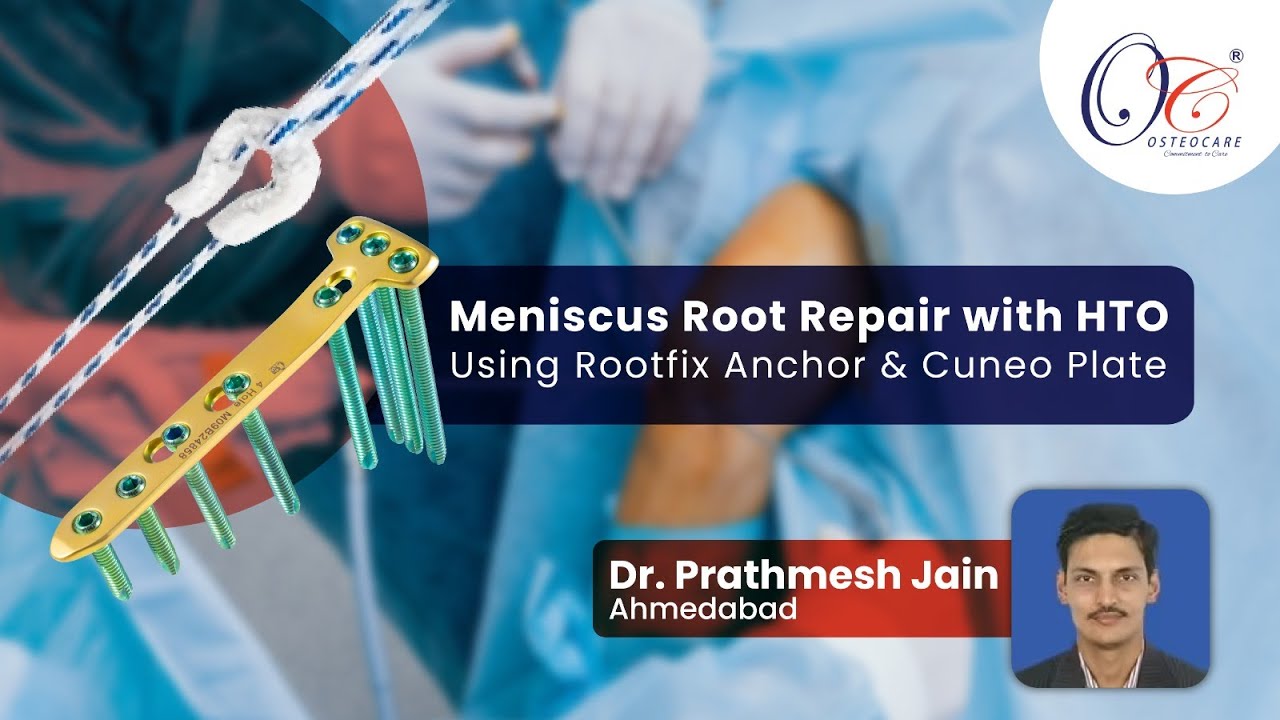 Meniscus Root Repair with HTO | Re-Live Surgery | Surgical Technique ...