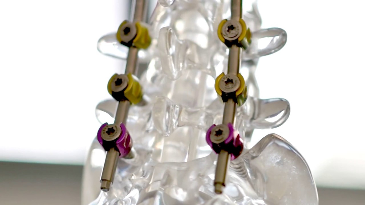 Opération rachis - Pôle rachi - Clinique Capio Belharra - YouTube