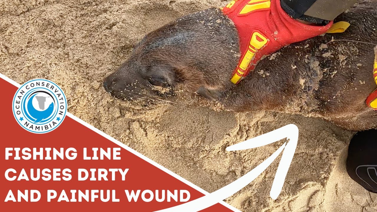 Fishing Line Causes Dirty And Painful Wound - YouTube