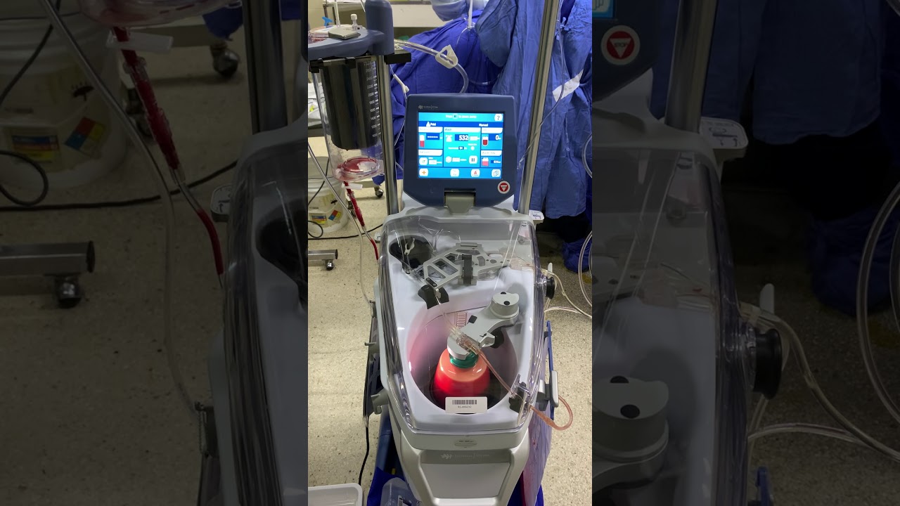 Funcionamiento de recuperador sanguíneo XTRA - YouTube